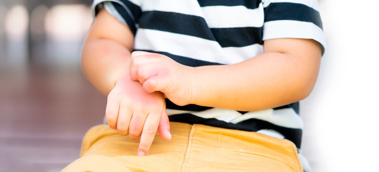 Il tuo bambino si gratta? Le cause possono essere tante e diverse ...